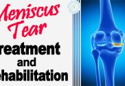 Meniscus Tear Treatment and Rehabilitation — Healing Through Movement